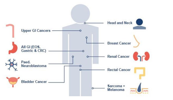“We are incredibly grateful” – Royal Marsden Cancer Charity on The ...